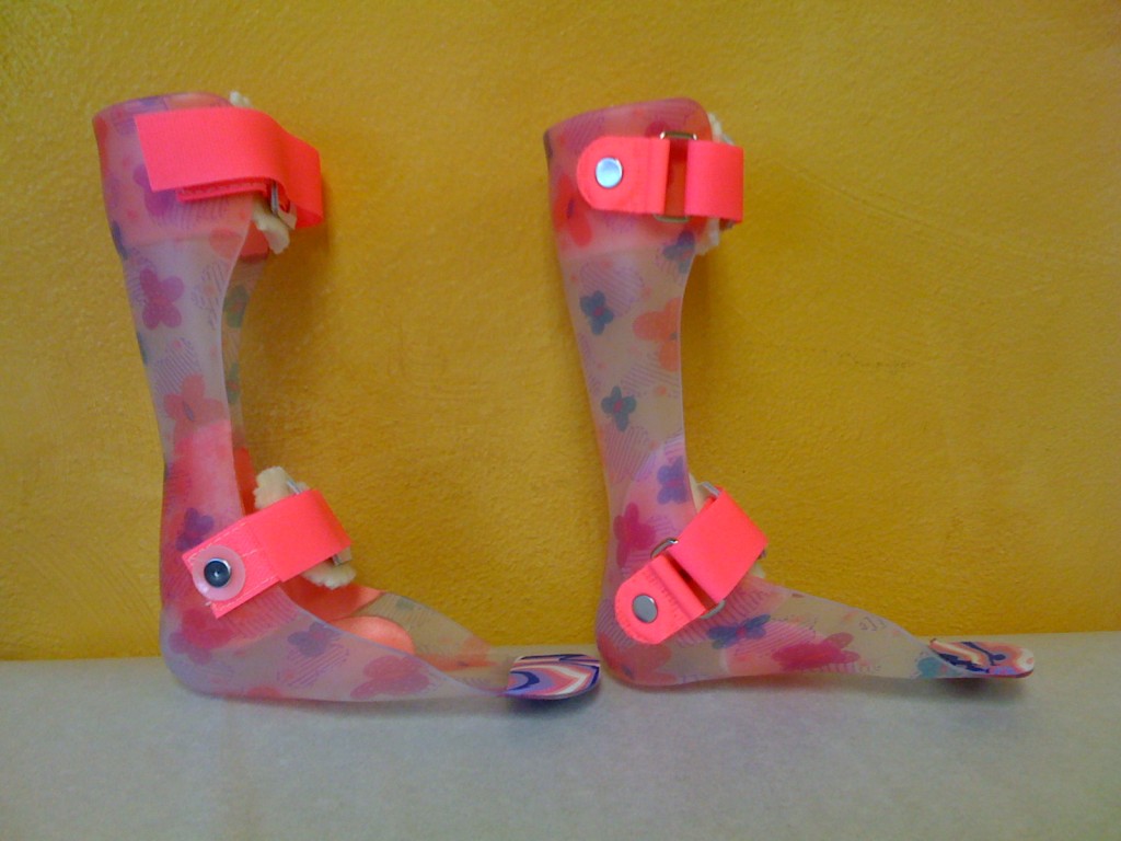 AFO (short leg) | Innovative Prosthetic Solutions, Inc.