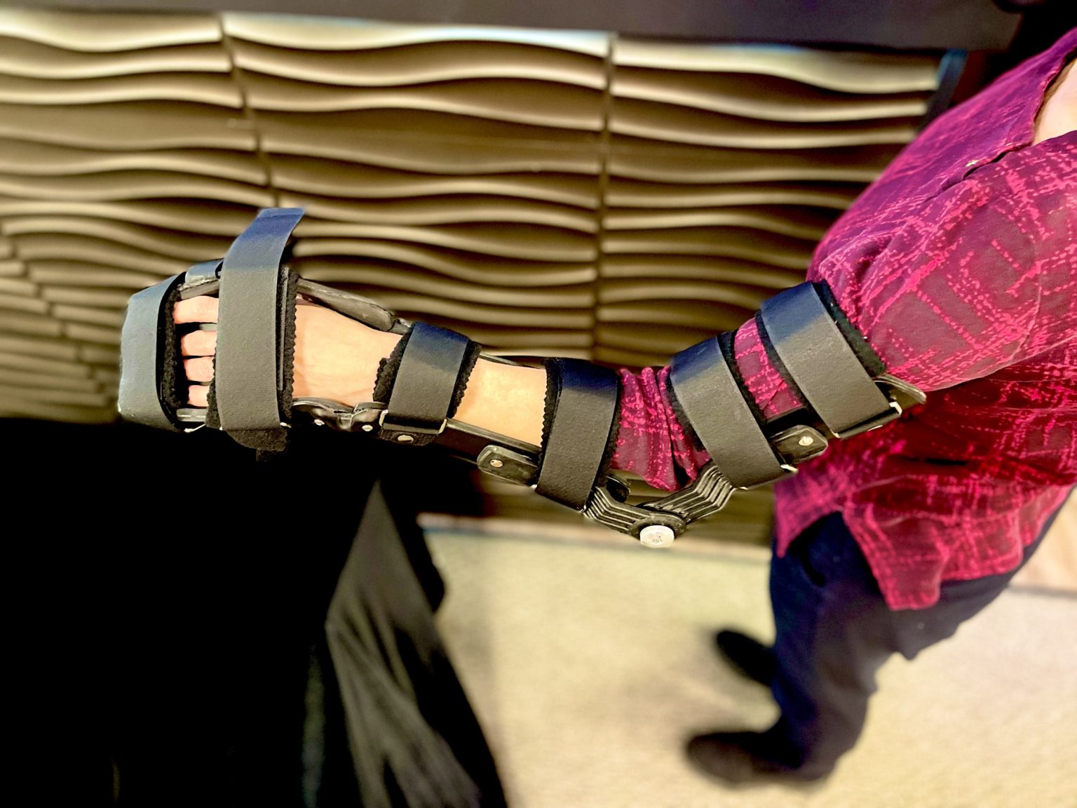 » EWHFO: Elbow Wrist Hand Finger Orthosis Innovative Prosthetic ...