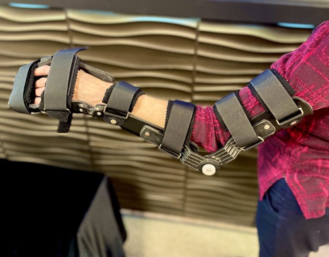 » EWHFO: Elbow Wrist Hand Finger Orthosis Innovative Prosthetic ...