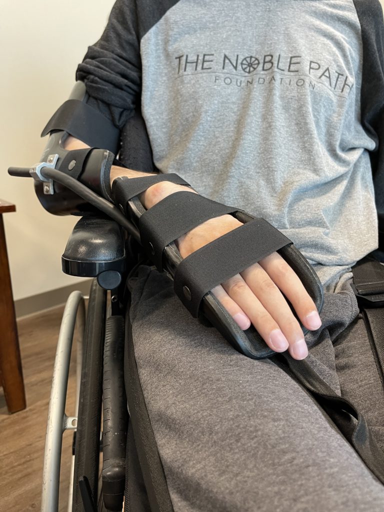 » Upper Extremity Supination Orthosis Innovative Prosthetic Solutions, Inc.