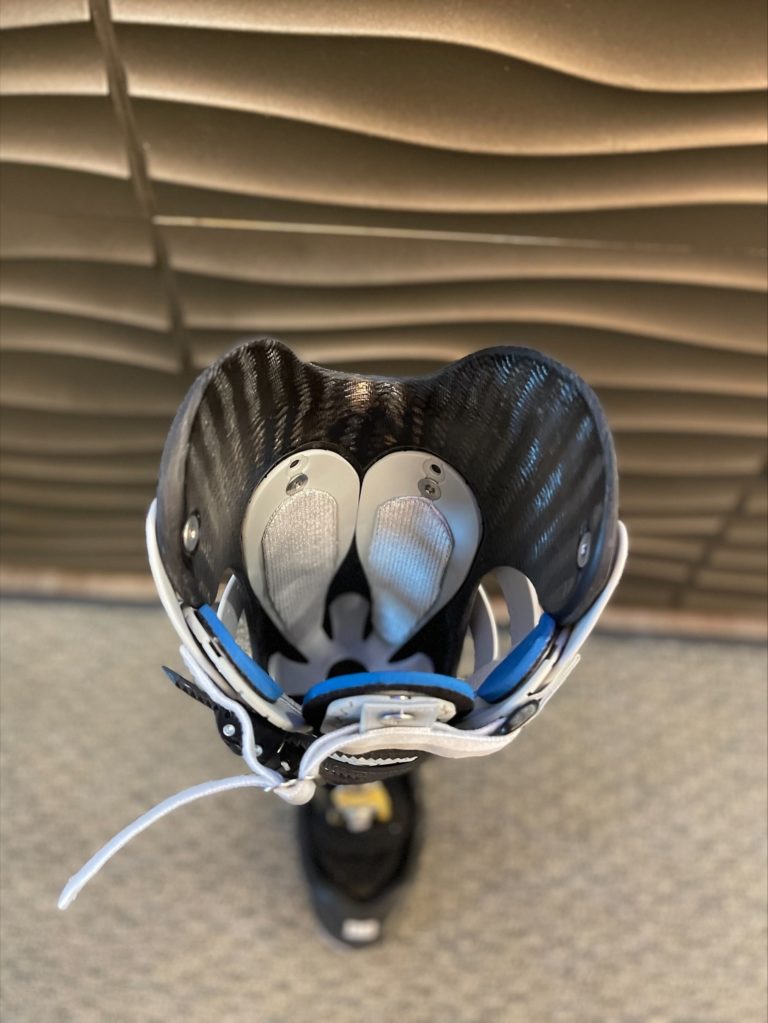 MARTIN BIONICS: SOCKETLESS SOCKET | Innovative Prosthetic Solutions, Inc.