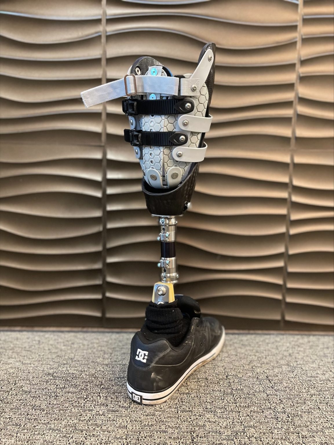 MARTIN BIONICS: SOCKETLESS SOCKET | Innovative Prosthetic Solutions, Inc.